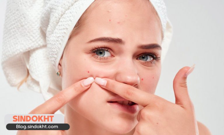 بهترین ضد جوش کدام است؟ راهنمای انتخاب و خرید ضدجوش مجله سین دخت